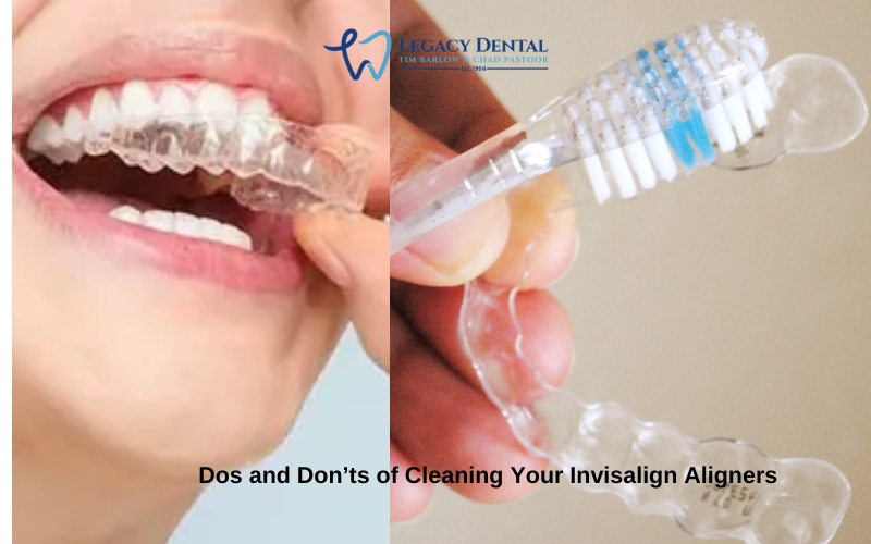 The Dos and Don’ts of Cleaning Your Invisalign Aligners